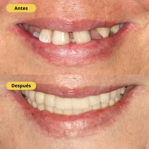 IOC Clínica Dental | Tenerife