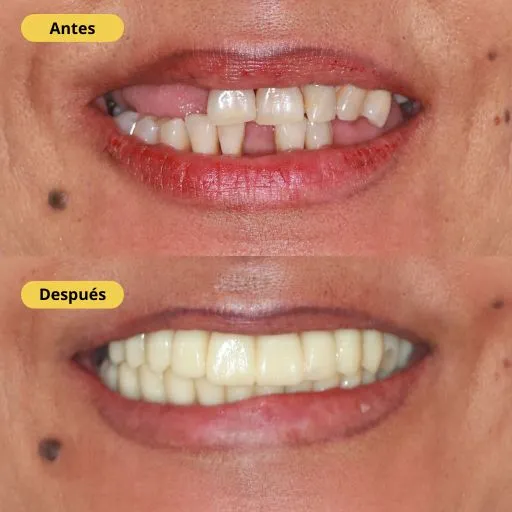 IOC Clínica Dental | Tenerife