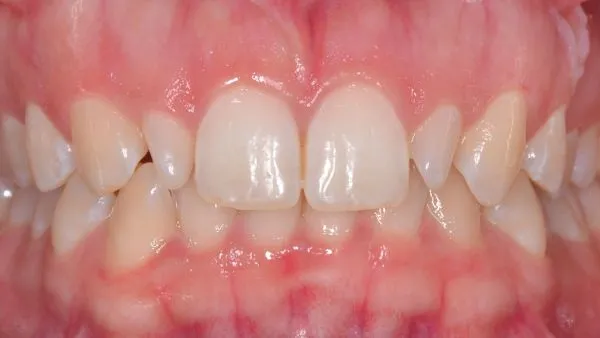 Galería de Sonrisas | IOC Clínica Dental
