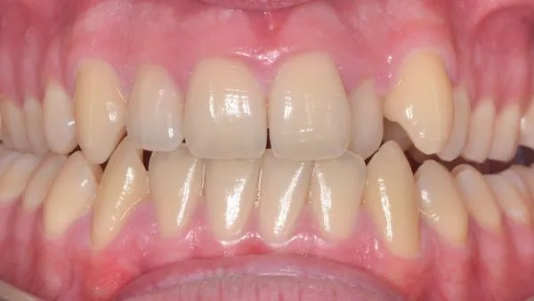 Galería de Sonrisas | IOC Clínica Dental