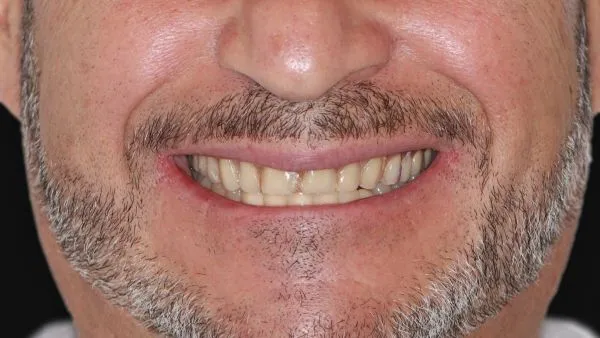 Galería de Sonrisas | IOC Clínica Dental