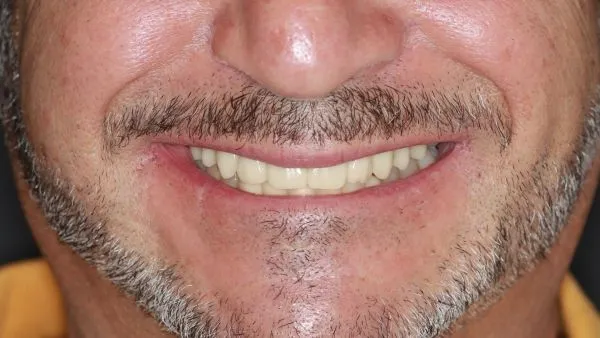 Galería de Sonrisas | IOC Clínica Dental